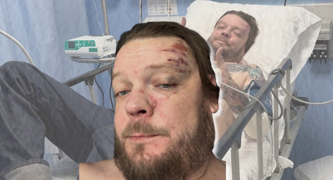 ¿Cómo fue el accidente de Corey Harrison, de “El precio de la historia ...