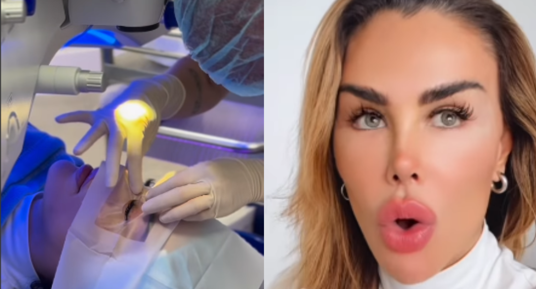 ¿Cuánto cuesta la cirugía para cambiar el color de ojos que se hizo ...